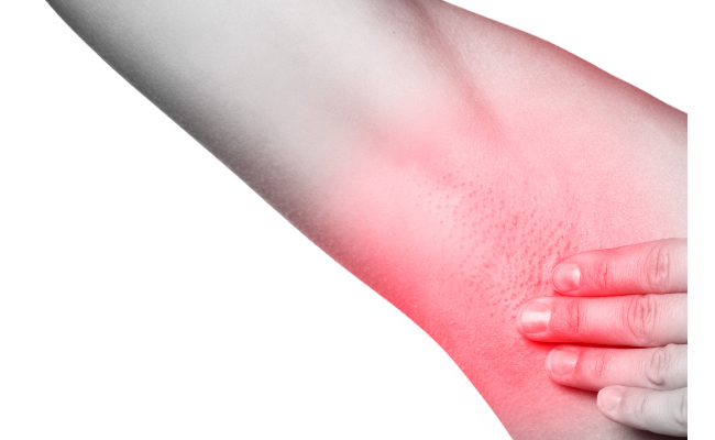 Painful Armpit Lumps: Unraveling Causes and Symptoms