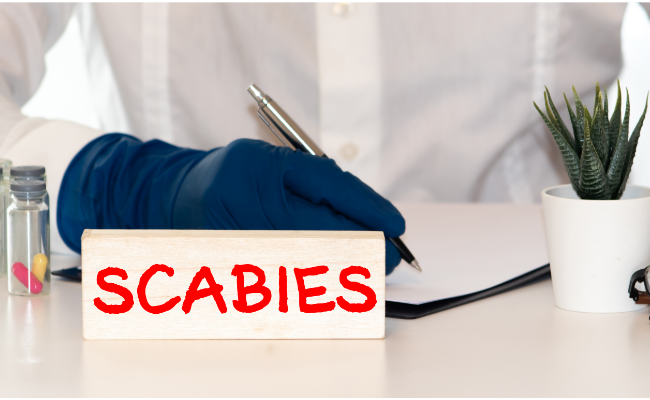 Effective Scabies Treatment Tips | Consult with Experts