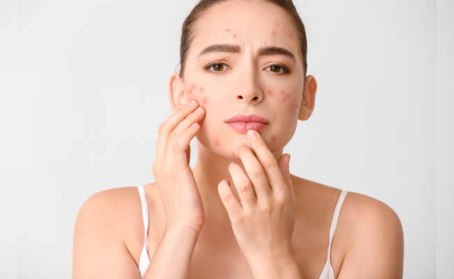 White Spots on Face: Get Expert Advice Now!