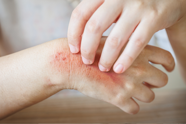 Tiny Rash on Child's Face and Body - Doctor's Guidance