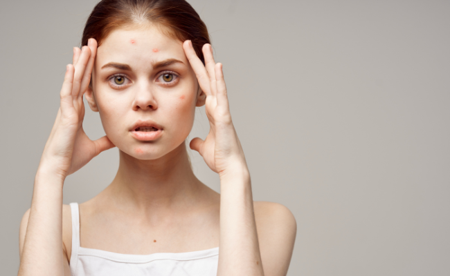 Pimple-Like Rash on the Back of Your Head? Get Expert Help!