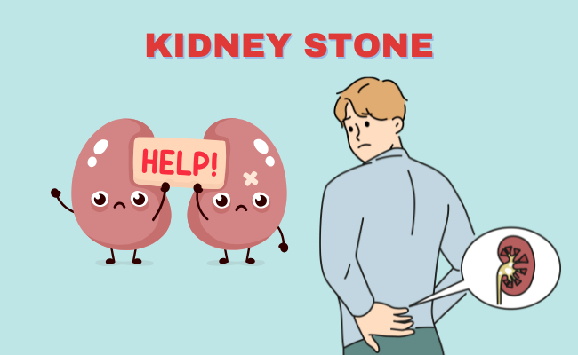 Why Does My Pain Persist After Passing a Kidney Stone?