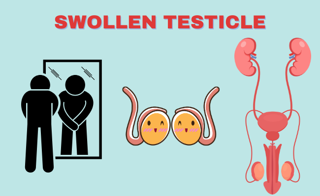 Swollen Testicle, Green Semen, and Low Arousal – Causes