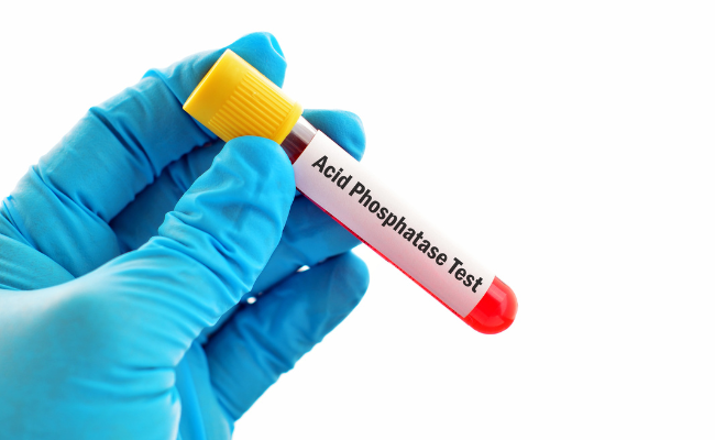 Is High ALP Normal During Pregnancy? Find Out Here